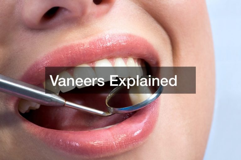 Vaneers Explained - E-Library